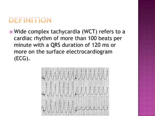 Wct Heart Rhythm