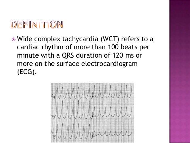 EP diagnosis of WIDE COMPLEX TACHYCARDIA