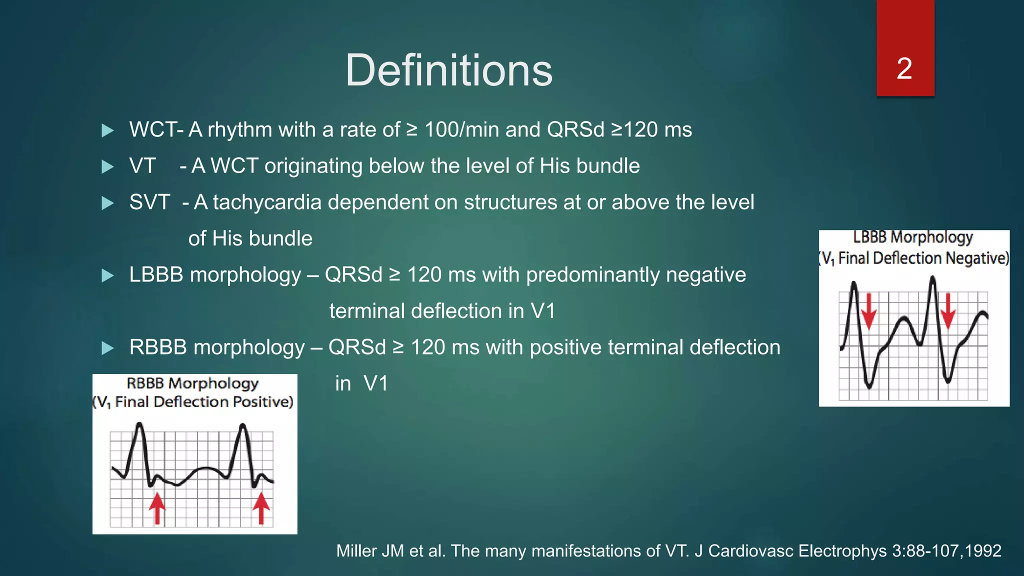 approach to wide complex tachycardia | PPTX