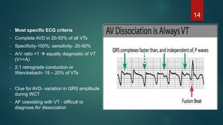 approach to wide complex tachycardia | PPTX