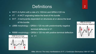 Wct Heart Rhythm