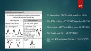 approach to wide complex tachycardia | PPTX