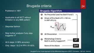 approach to wide complex tachycardia | PPTX