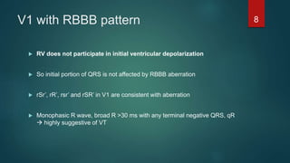 approach to wide complex tachycardia | PPTX