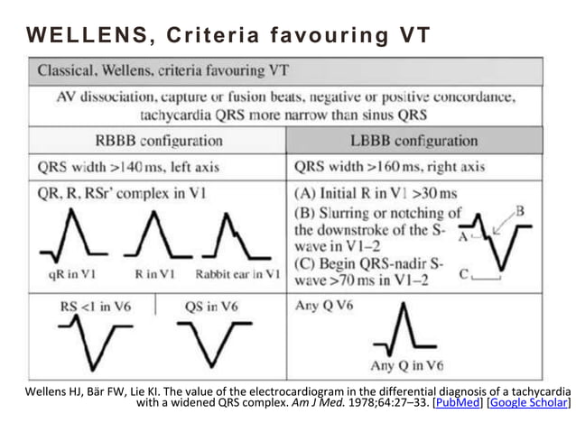 Wide QRS Complex Tachycardia (VT vs SVT) | PPTX | Heart and ...