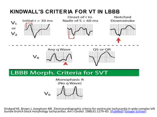Wide QRS Complex Tachycardia (VT vs SVT) | PPTX | Heart and ...