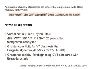 Wide QRS Complex Tachycardia (VT vs SVT) | PPTX