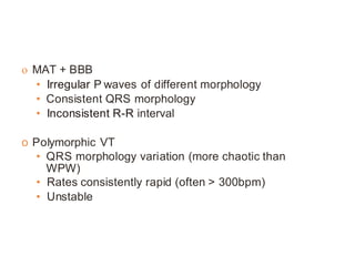 Wide QRS Complex Tachycardia (VT vs SVT) | PPTX