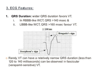 Wide QRS Complex Tachycardia (VT vs SVT) | PPTX | Heart and ...