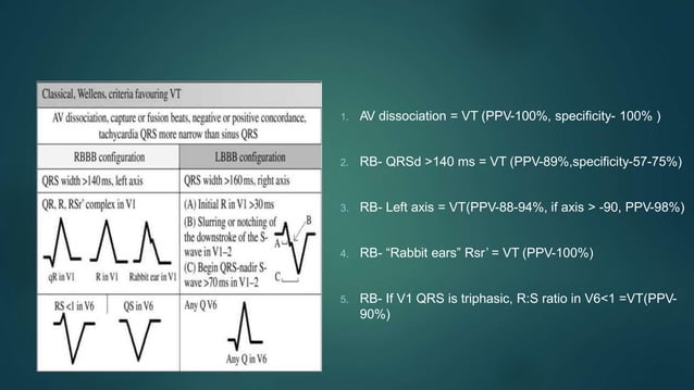 Wide complex tachycardia | PDF