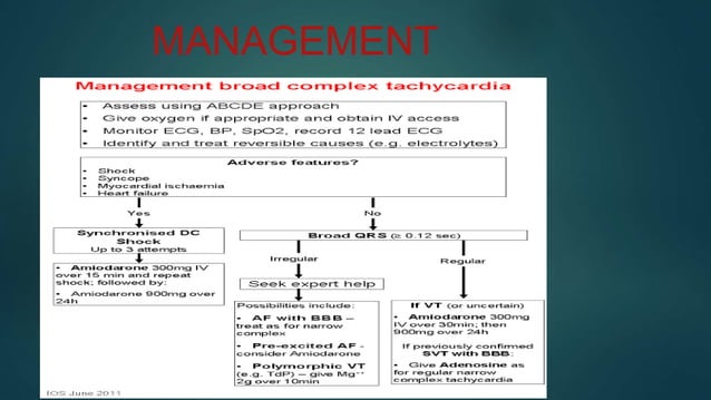 Wide complex tachycardia | PDF