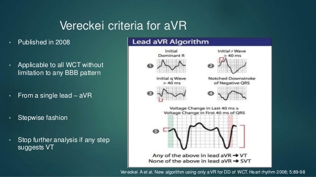 Wide complex tachycardia
