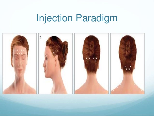 Via Christi Women's Connection: Migraines