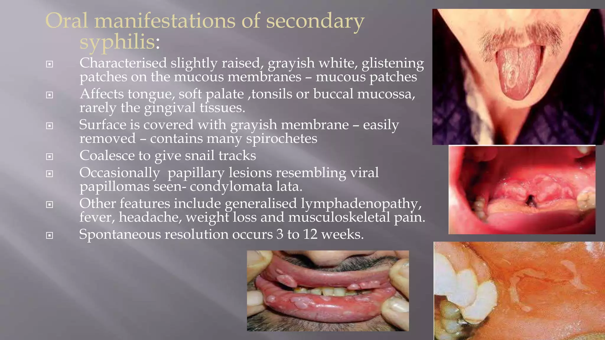 Non keratotic white lesions of the oral cavity | PPTX