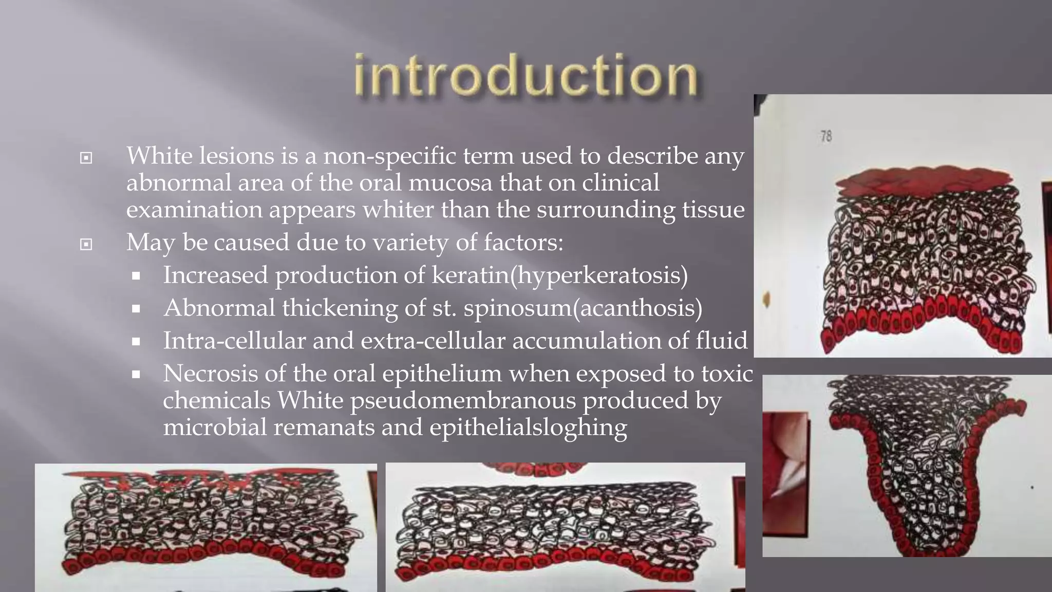 Non keratotic white lesions of the oral cavity | PPTX