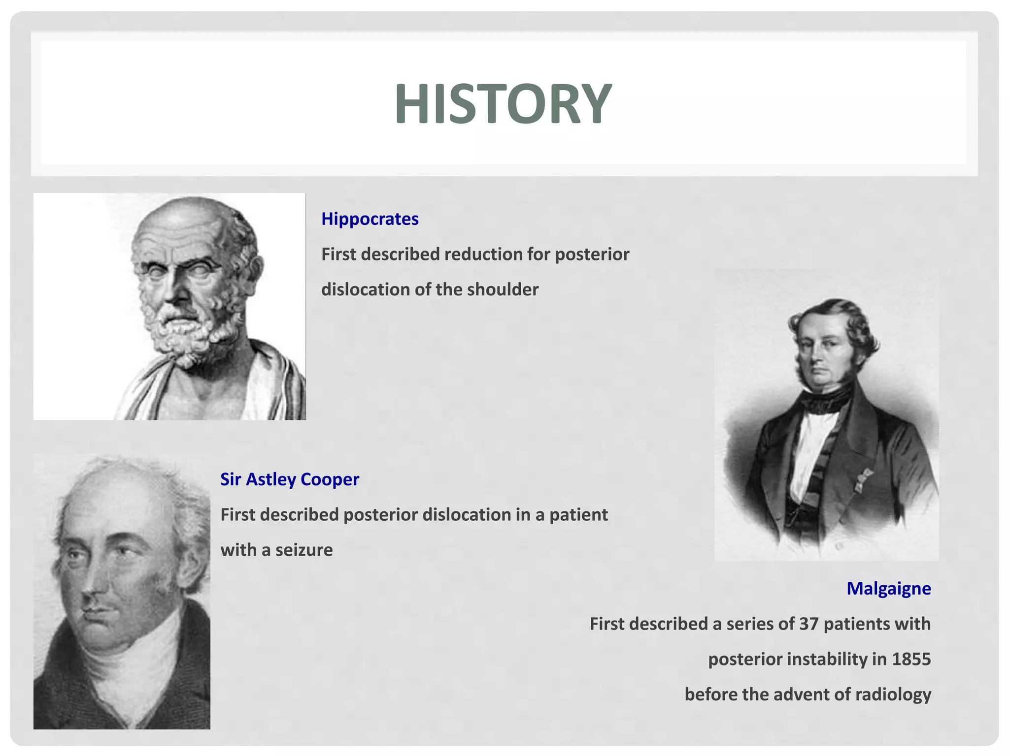 Posterior shoulder dislocation 2 | PPTX