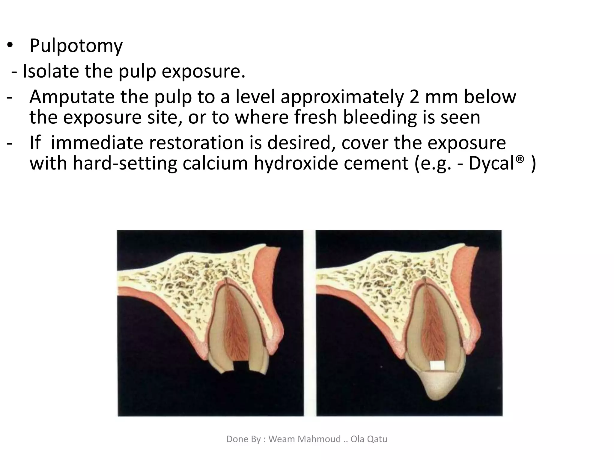 Dental Trauma | PPSX