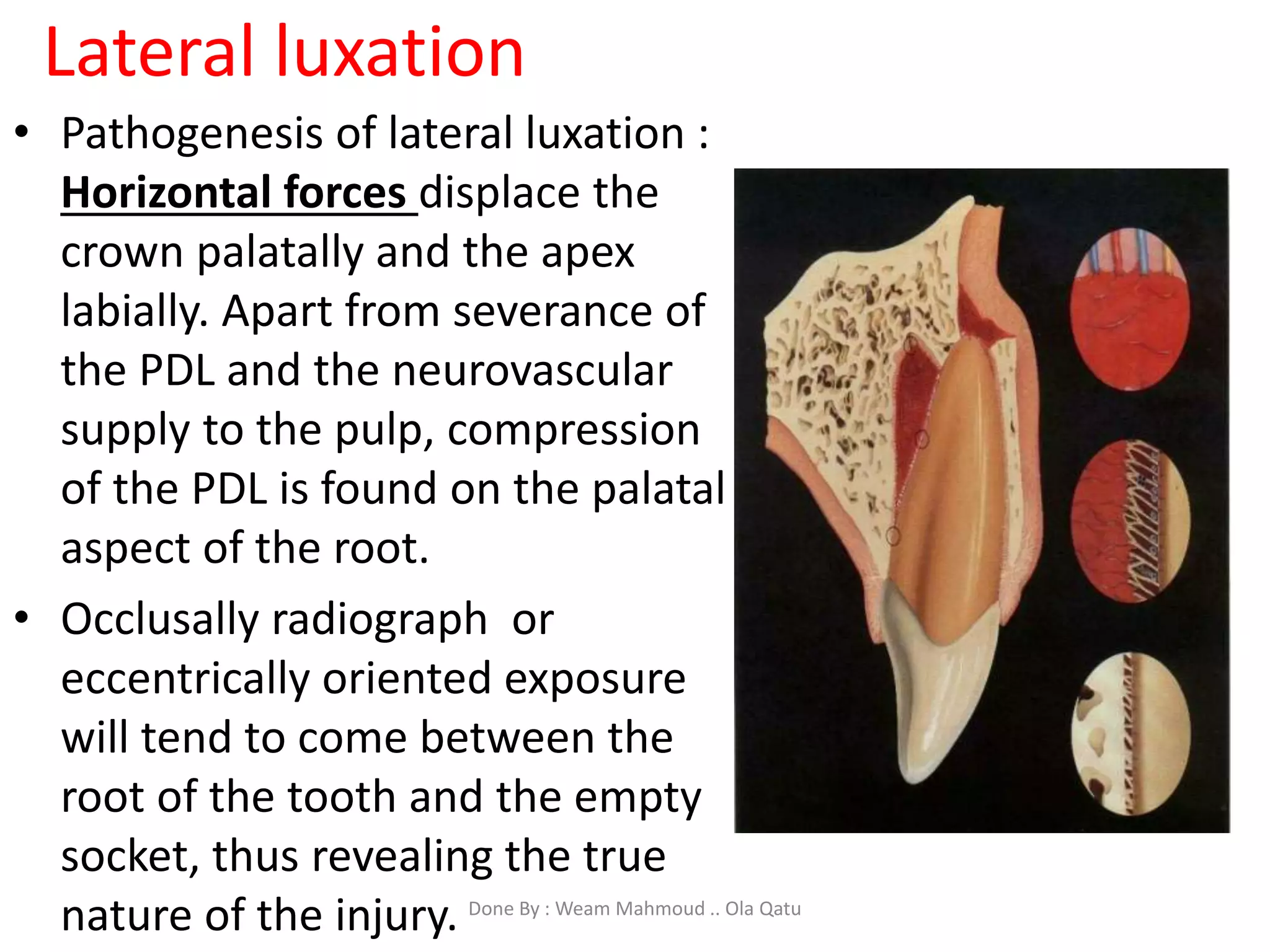 Dental Trauma | PPSX