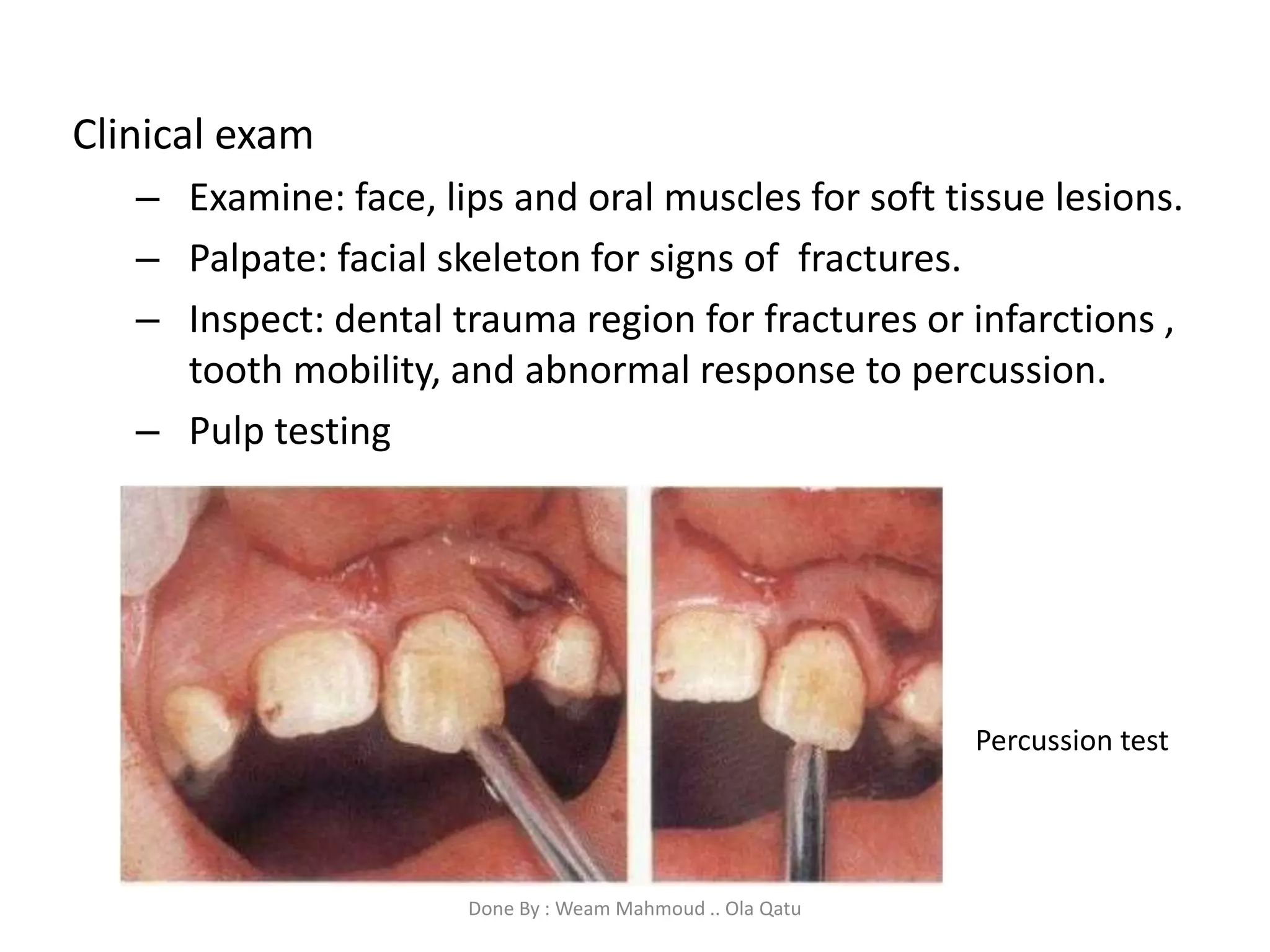 Dental Trauma | PPSX