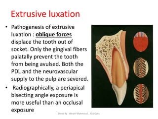 Dental Trauma | PPSX