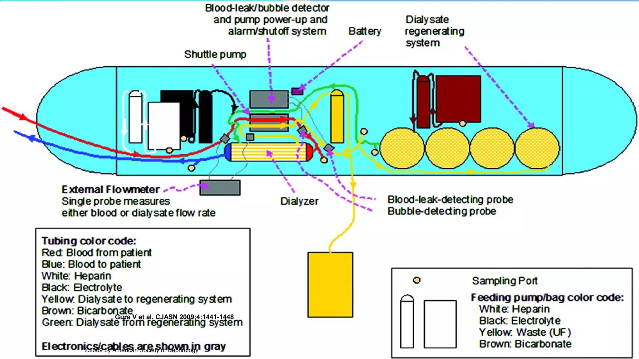 Wearable artififial kidney and bioimplantable kidney by Dr Vishnu RS | PPT