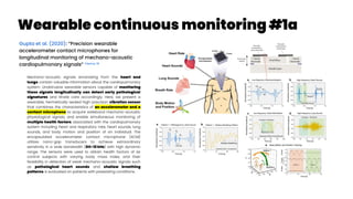 Wearable Continuous Acoustic Lung Sensing | PDF