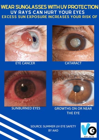 Effects of uv to the eyes | PDF