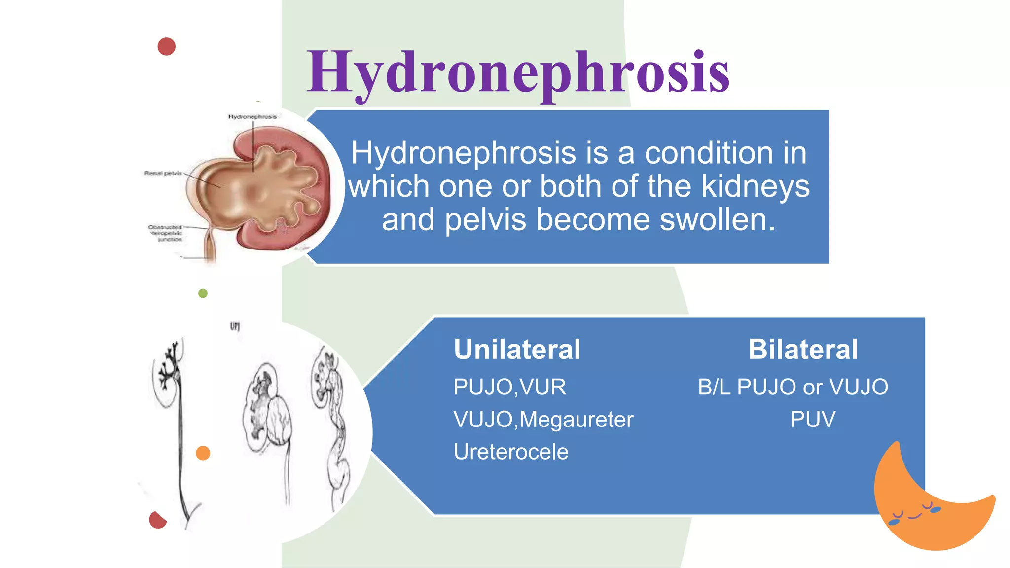 Nursing management of genito urinary disorders in children | PPTX