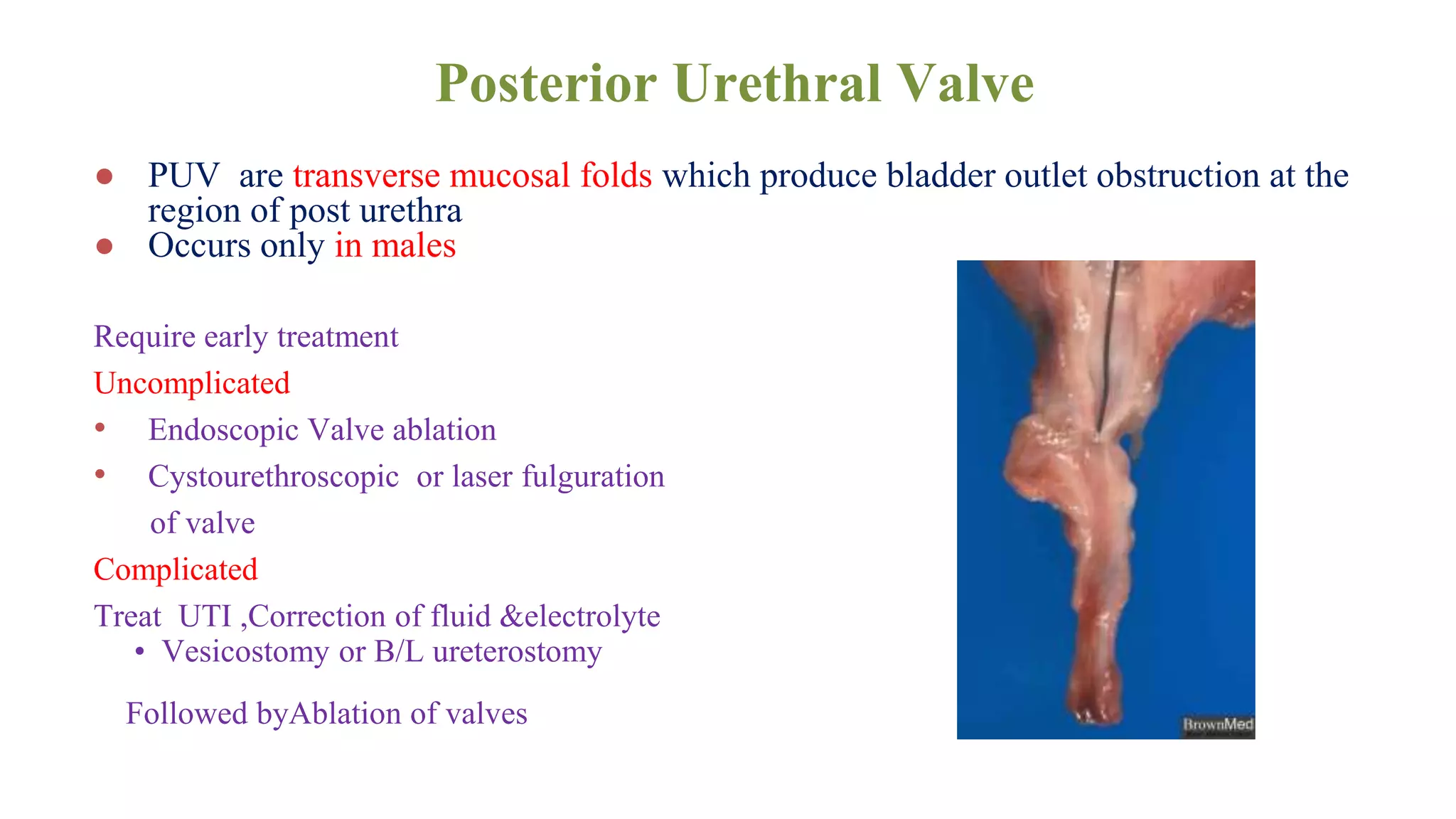 Nursing management of genito urinary disorders in children | PPTX