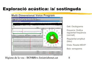 Higiene de la Veu | PPT
