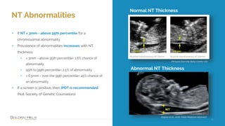 Prenatal Genetic Screening with VarSeq | PPTX