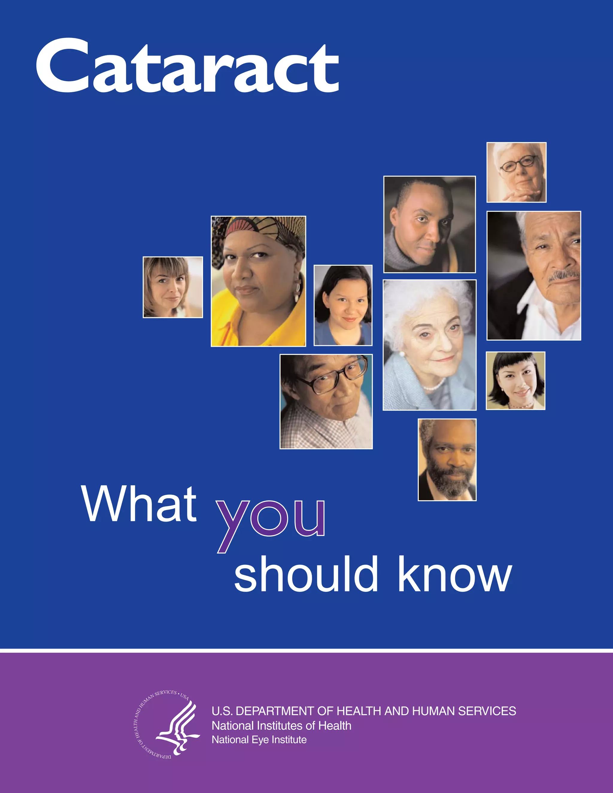 Global Medical Cures™ | CATARACT (What you should know) | PDF