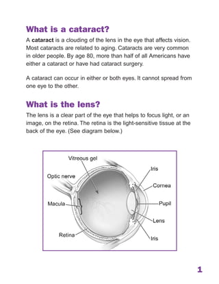 Global Medical Cures™ | CATARACT (What you should know) | PDF