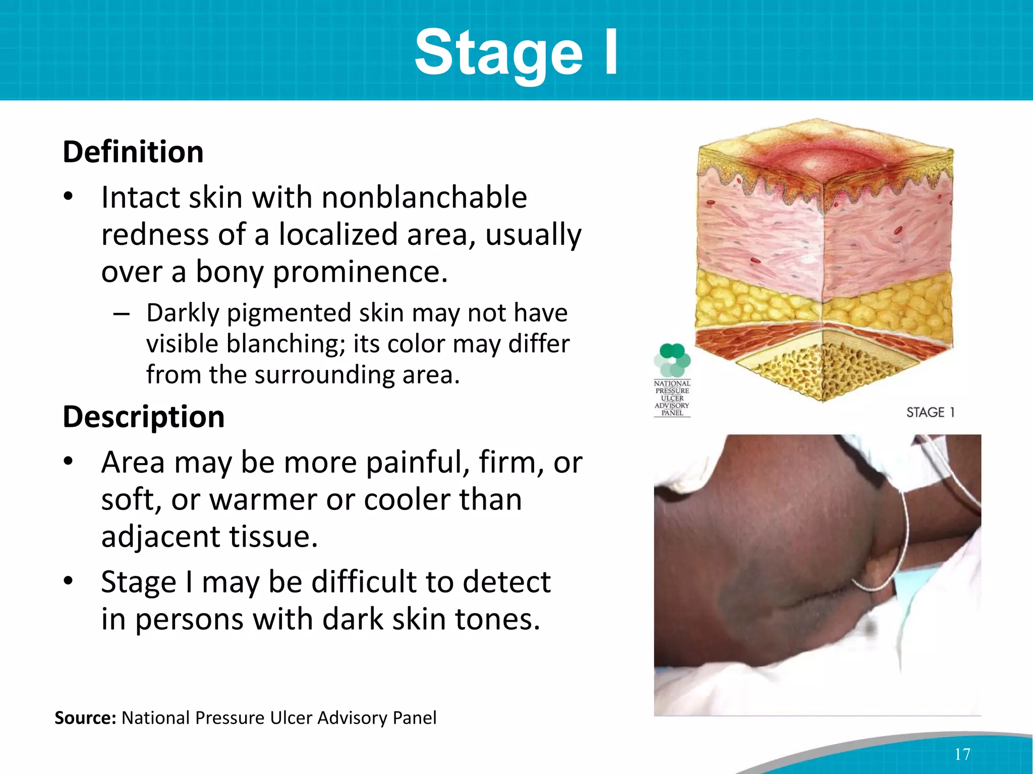 webinar6_pu_woundassesst (1).pdf
