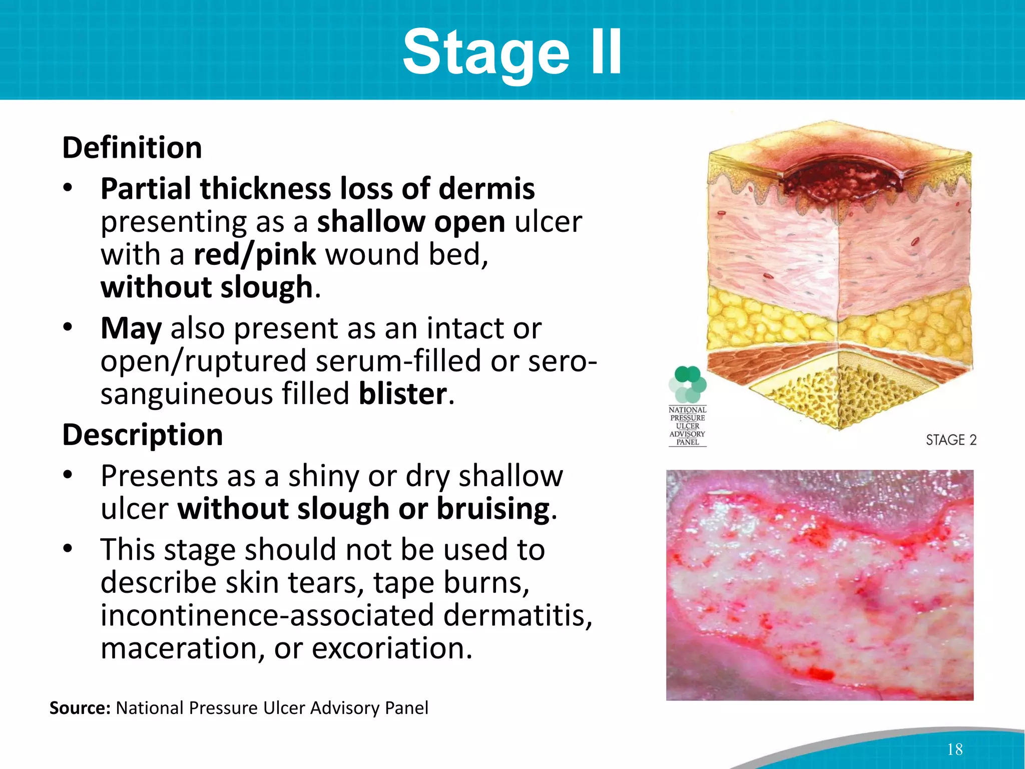 webinar6_pu_woundassesst (1).pdf