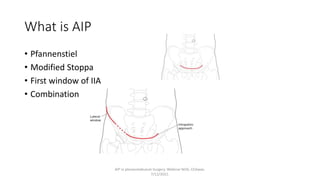 Webinar AIP for pelviacebulum surgery.pptx