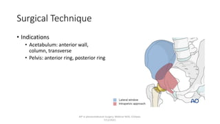 Webinar AIP for pelviacebulum surgery.pptx