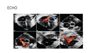ASD case presentation Ideal Case | PPTX