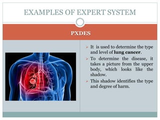 Artificial Intelligence and Expert System | PPT