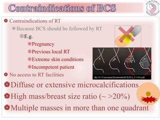 Oncoplastic Breast Surgery; Principles of Techniques and Indications | PDF