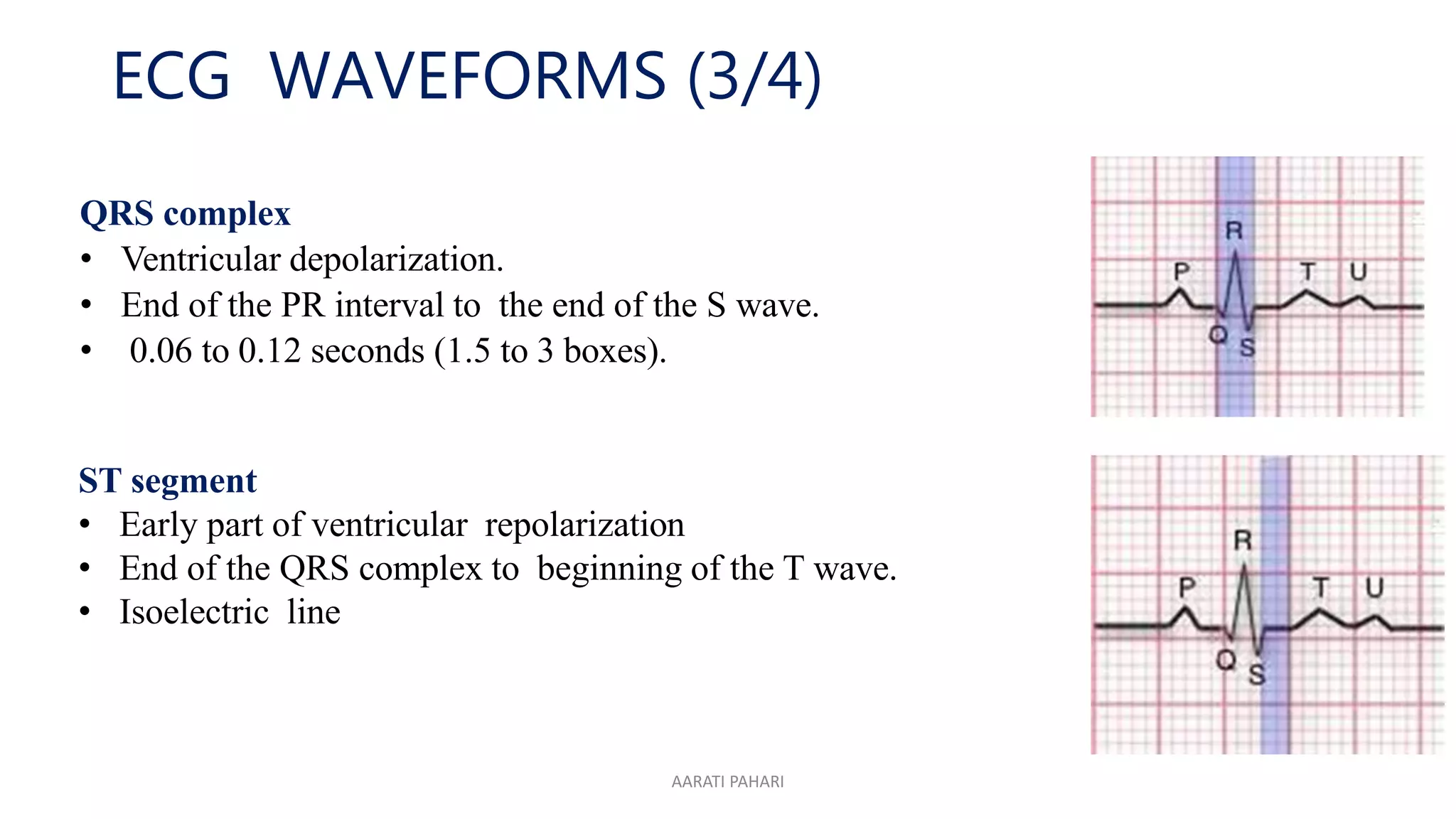 ECG AND ITS INTERPRETATION.pptx