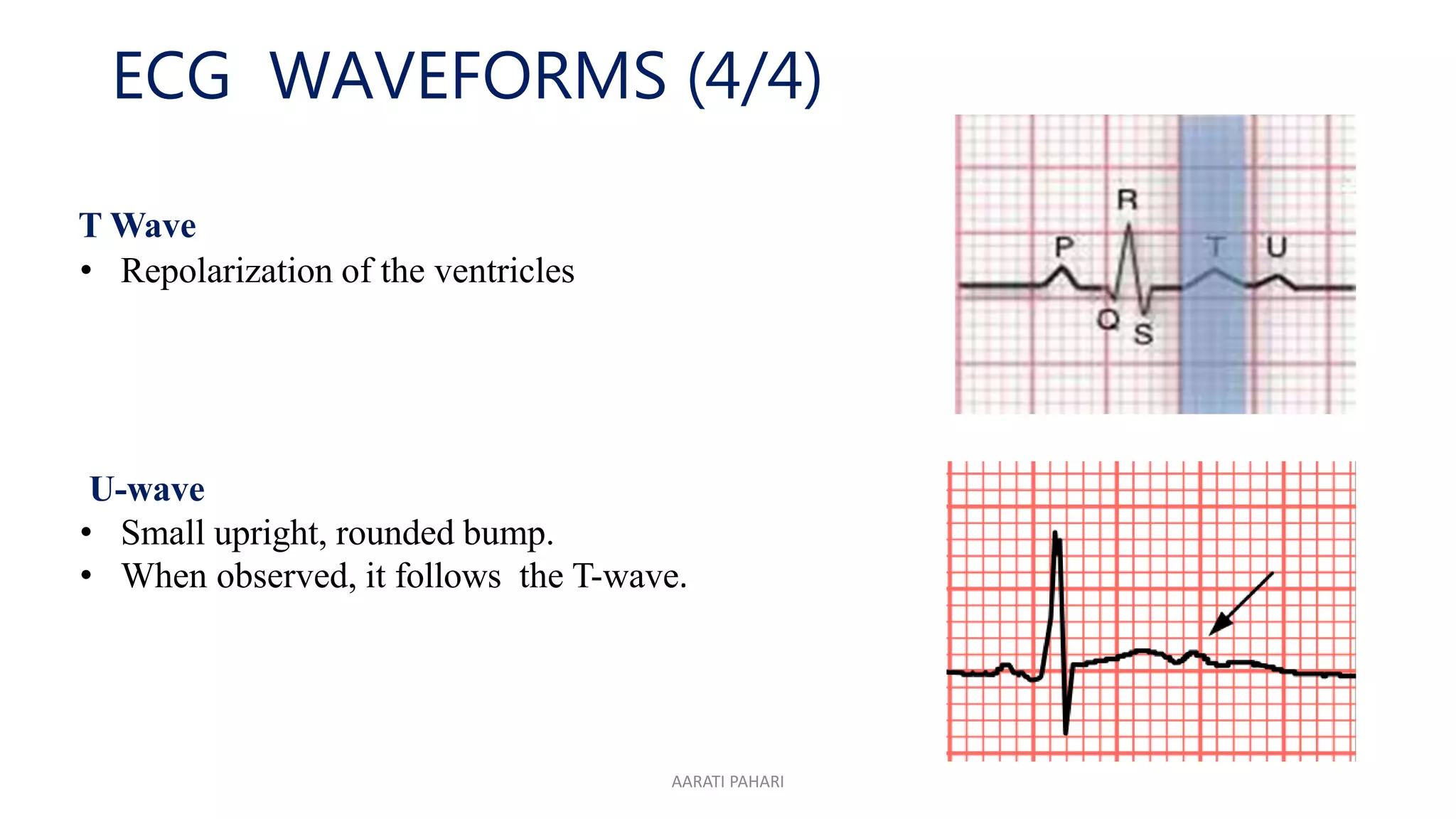 ECG AND ITS INTERPRETATION.pptx