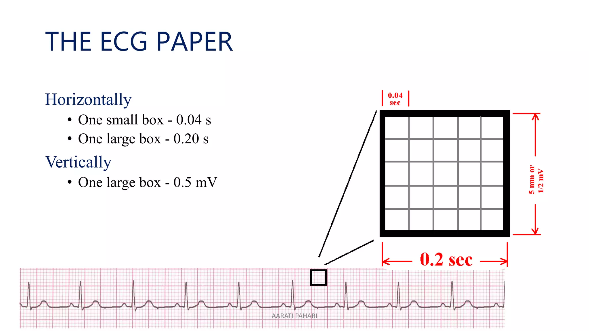 ECG AND ITS INTERPRETATION.pptx