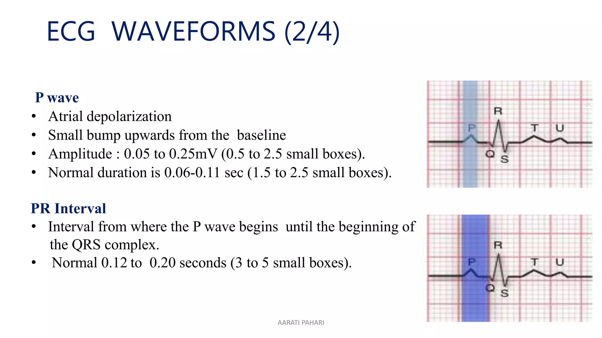 ECG AND ITS INTERPRETATION.pptx