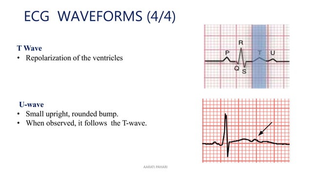 ECG AND ITS INTERPRETATION.pptx