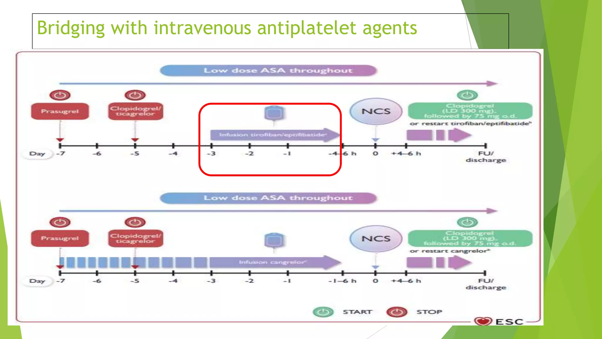 anesthesia in patient a patient with IHD posted for lap cholecystectomy. presentation.pptx