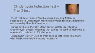 Antibiotic Sensitivity Testing 2020 Update | PPT