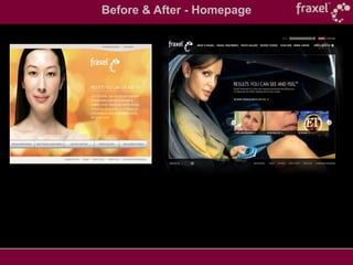 Website Redesign - Before and After | PPT