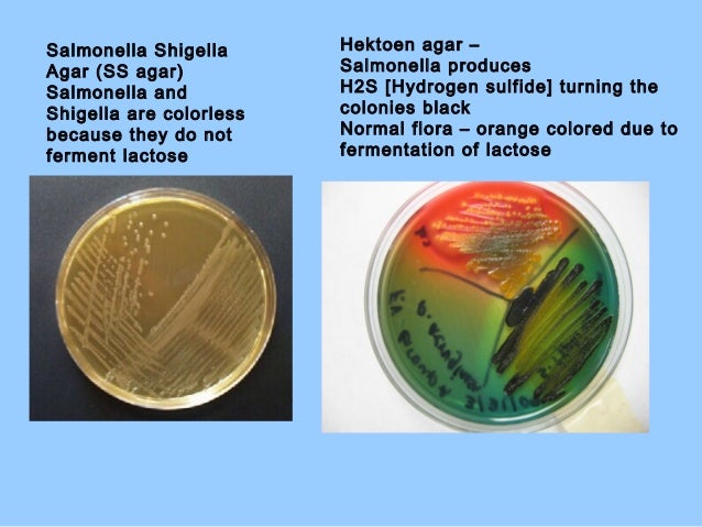 Hektoen Enteric Agar Positive Result