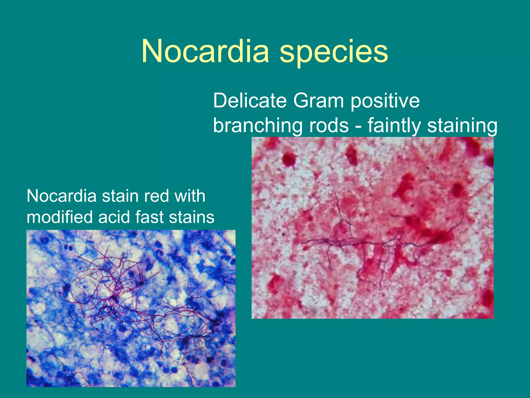 Gram Stains | PPT